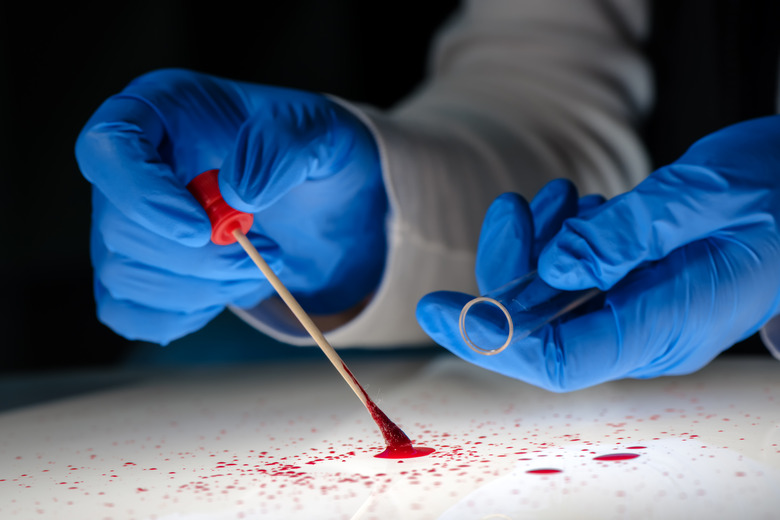 Forensic Serology and Biology | Blood, Semen & DNA Evidence